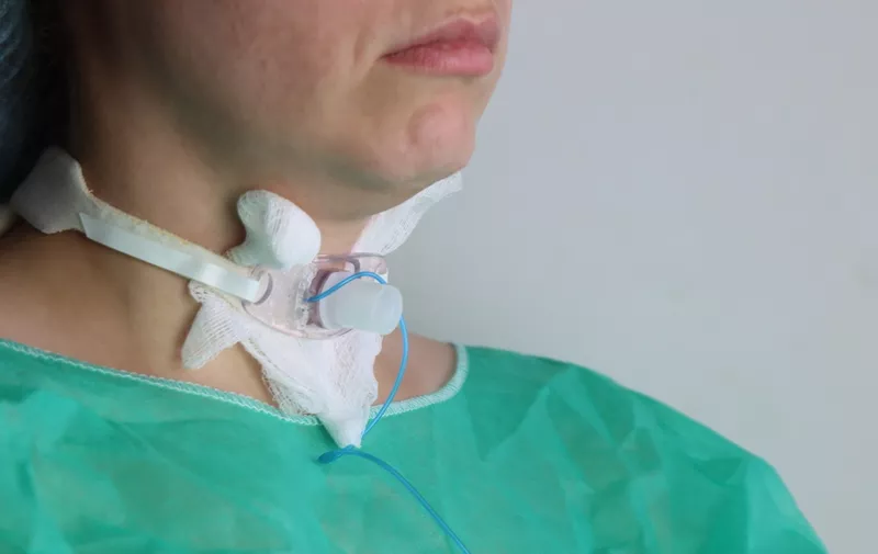 Što je stoma, zašto se postavljaju i kako se pravilno njeguju ...