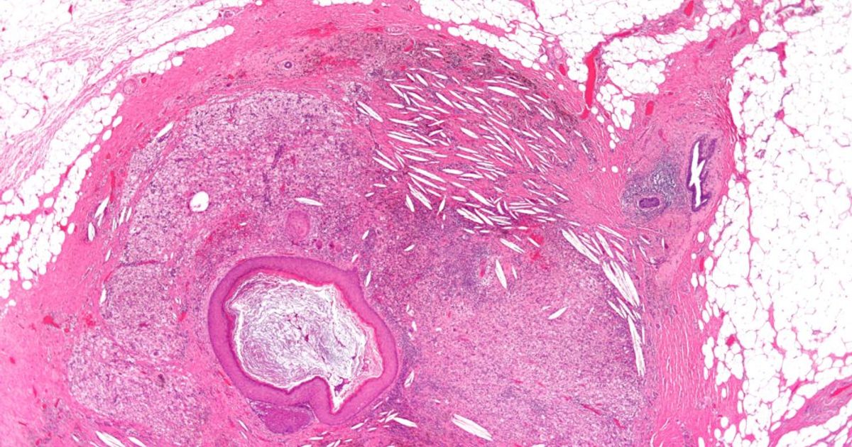 Znanstvenici ispituju važan lijek; tvrde da je na 16 mjeseci uspio ...