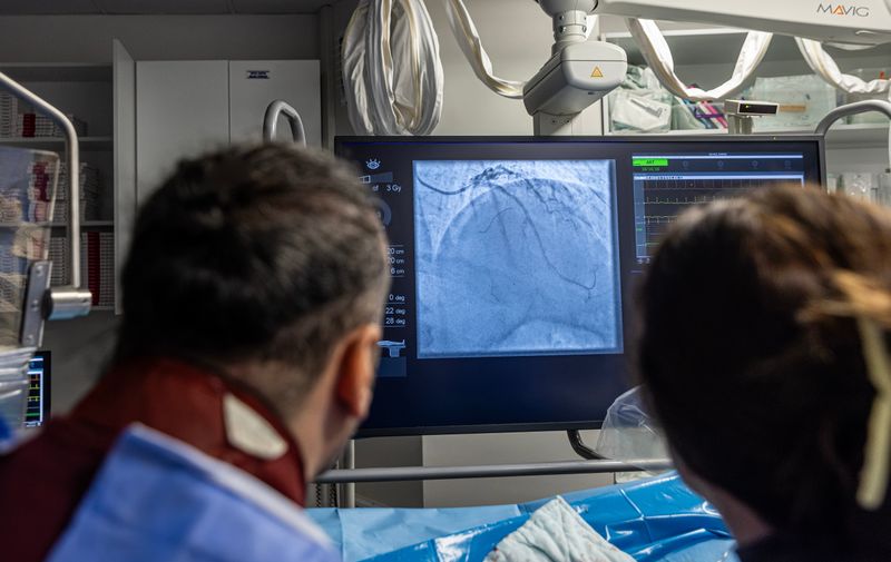 Koronarografija: Kako se radi invazivna, a kako MSCT metoda? | Telegram.hr