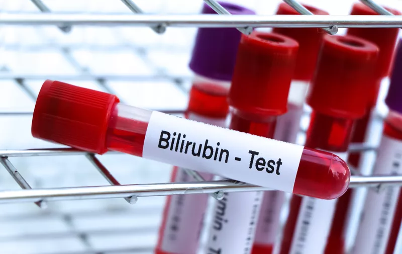 Slezena: Bol i simptomi povećane slezene, znakovi infekcije | Telegram.hr