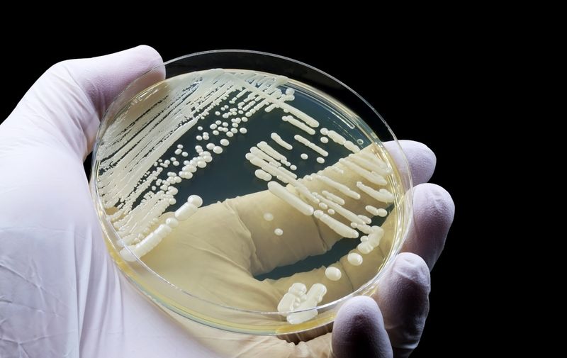 Kandida: Simptomi, najčešće vrste i antikandida dijeta | Telegram.hr