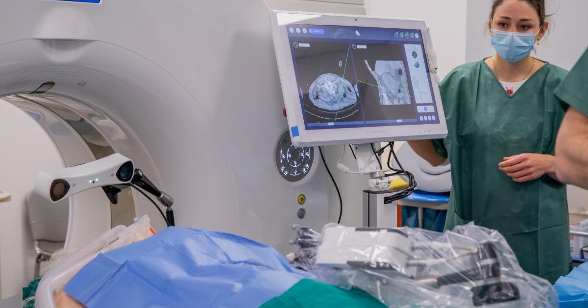 Novi fantastičan uspjeh hrvatskih liječnika: U KBC-u Sestre milosrdnice robotskom rukom uništili ...