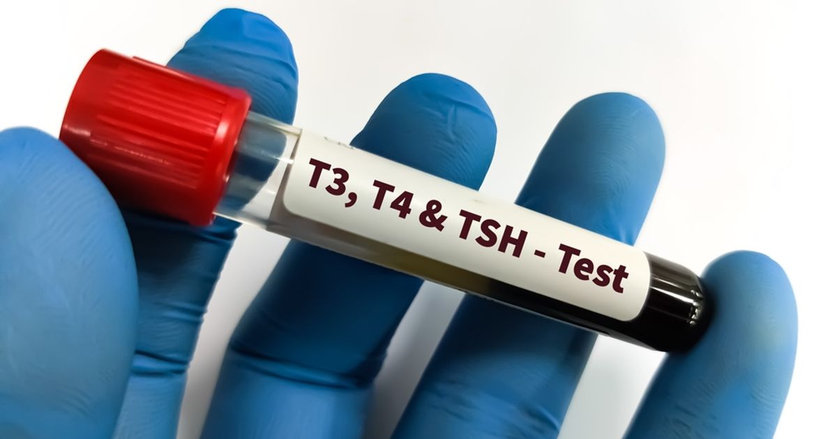 TSH nalaz: koje su normalne vrijednosti hormona štitnjače? | Telegram.hr
