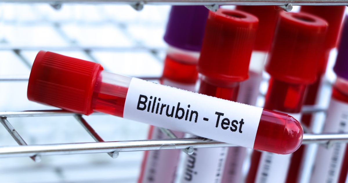 Bilirubin u krvi: Normalne vrijednosti i uzrok povišenog bilirubina ...