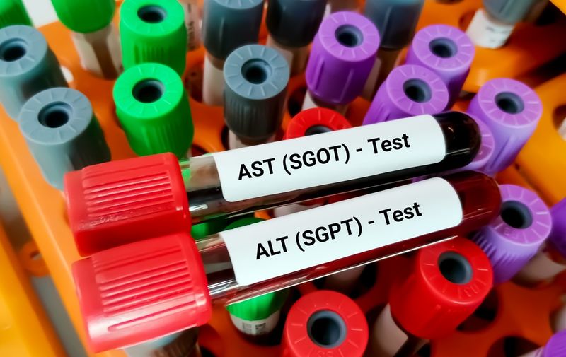 Jetrene probe: Normalne vrijednosti i što znače povišeni nalazi ...